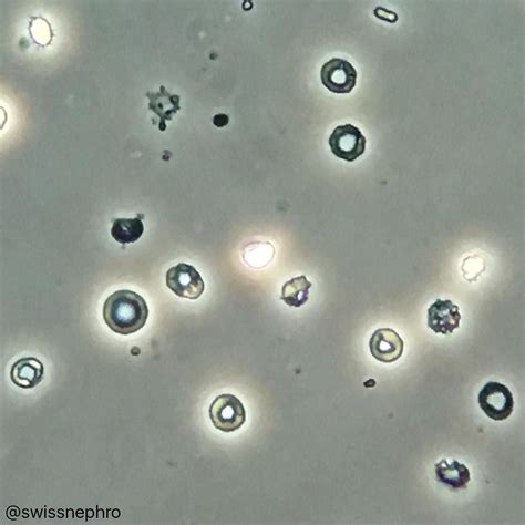 Pin Auf Nephro Pics