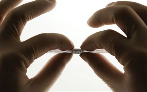 Nitinol The Shape Memory Alloy Revolutionizing Materials Science Ashutosh Viramgama Shape