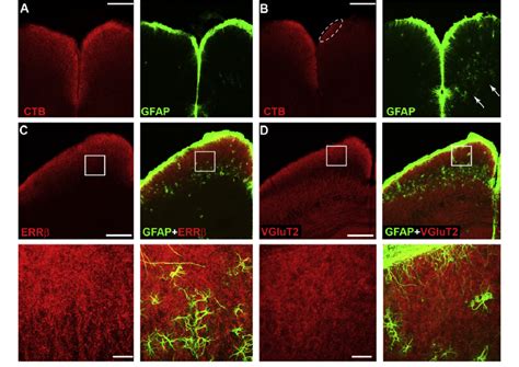 Astrocyte Hypertrophy Accompanies Transport Depletion And Precedes Download Scientific Diagram