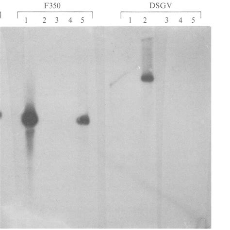 Dot Blot Hybridization Of Nucleic Acid Extracts From Symptomatic And