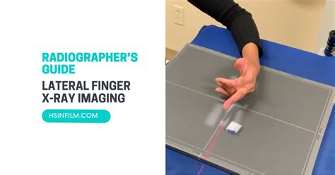 A Radiographers Guide To Lateral Finger X Ray Imaging Hsin Film