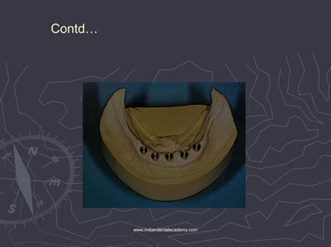 Classification And Impression Techniques Of Implants Dentistry Dental