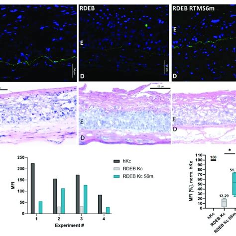 Dif Showing Granular Pattern Of Iga Deposits Along Dej Download Scientific Diagram