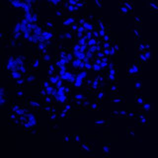 Flowchart For Nuclei Segmentation Taken From 7 Download Scientific Diagram