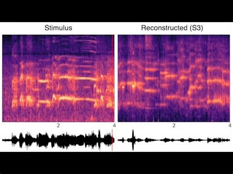Sound Reconstruction From Human Brain Activity Park Et Al 2023 S1 Ignacio Enrique Armas