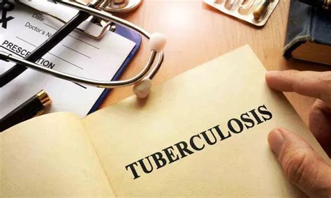 UP Expands TB Detection Campaign To All Districts