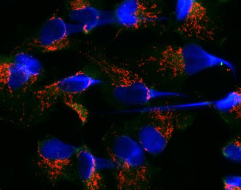 Troubleshooting For Streaky DAPI With Methanol Fixation ResearchGate
