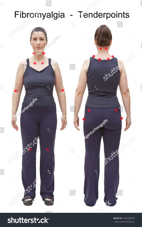 Common Trigger Points Royalty Free Photos And Stock Images Shutterstock