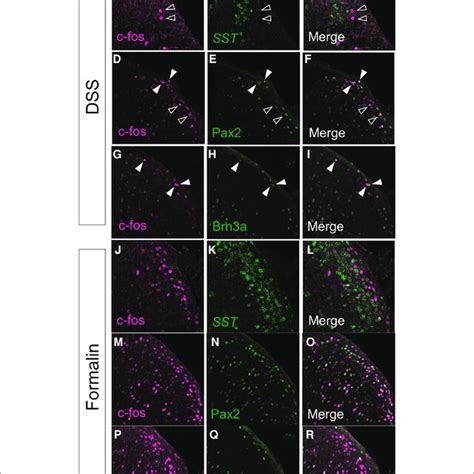 Immunostaining Of C Fos Together With Several Molecular Markers In The Download Scientific