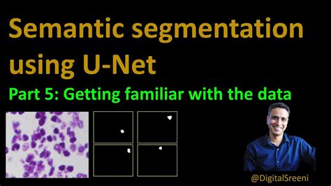 Image Segmentation Using U Net Understanding The Data