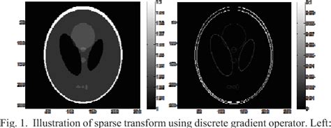 Figure 1 From Anisotropic Total Variation For Limited Angle Ct