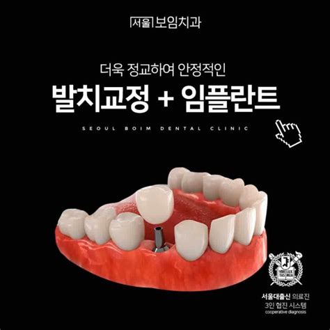 운정치과 발치교정임플란트 치료 사례 네이버 블로그