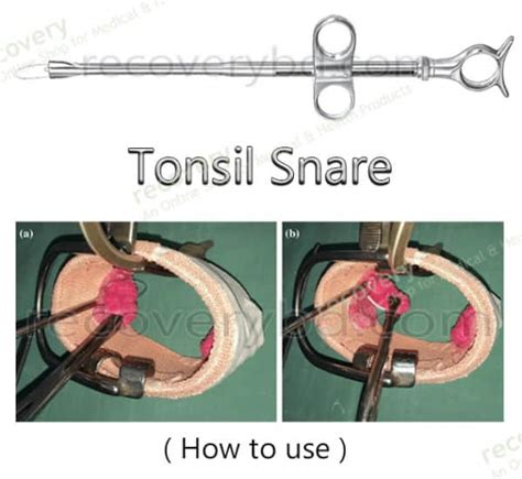 Tonsil Snare Eves Tonsil Snare Tonsil Surgery Instrument