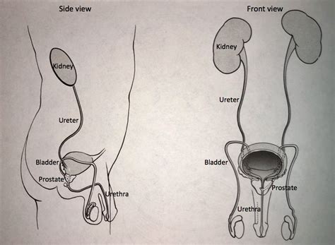 Prostatectomy Diagram