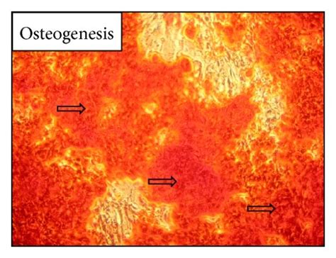Isolation And Trilineage Differentiation Of Mouse Bone Marrow Mscs Download Scientific Diagram