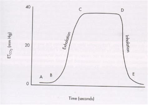Monitoring Flashcards Quizlet