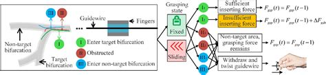 Figure 1 From Grasping Force Based Passive Safety Method For A Vascular Interventional Surgery