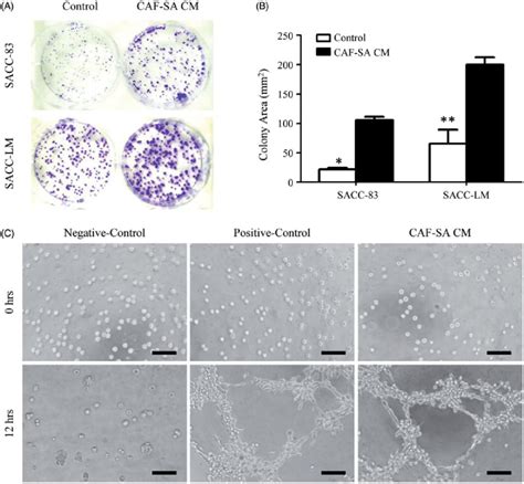 Clonogenic Assay And Tube Formation Assay A Clonogenic Assay Download Scientific Diagram
