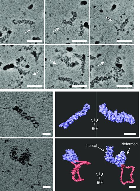 Cryo Em Observation Of Vrnps During Rna Synthesis An In Vitro Download Scientific Diagram