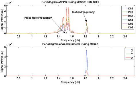Improving Pulse Rate Measurements During Random Motion Using A Wearable