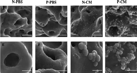 Topology Of Ti Implant Surface Analyzed Using Sem Under × 10000