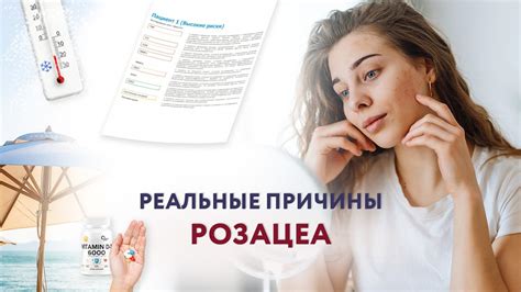 Причины розацеа питание инсоляция витамин D генетика Youtube