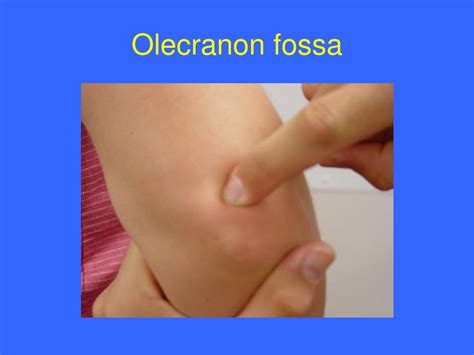 Ppt Elbow Forearm Lab Powerpoint Presentation Free Download Id 3058489