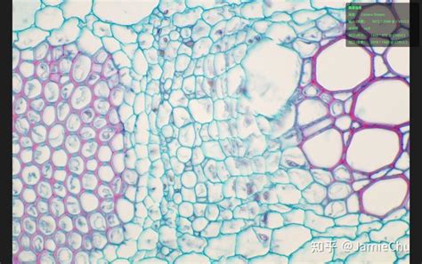 显微观察 双子叶植物茎横切（重制） 知乎