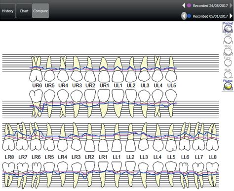 Periodontal Charting Uk