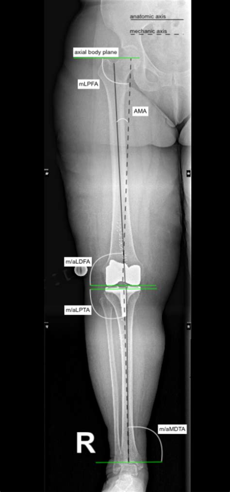 Imaging References Illustrating The Main Axes And Reference Angles