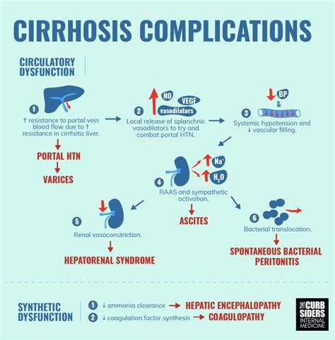 Managing Cirrhosis Related Complications Ascites Hepatic