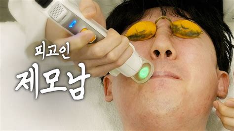 5회차 수염 레이저 제모 턱수염 인중 구렛나루 얼굴 전체 피고인의삶 Youtube