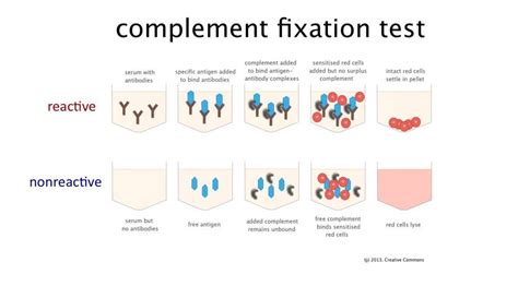 the complement fixation test the laboratory curie