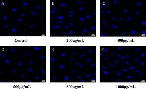 Fluorescent Microscopic Images Showing The DAPI Staining To Identify Download Scientific