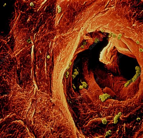 Sweat Gland Pore Sem Stock Image C0489374 Science Photo Library