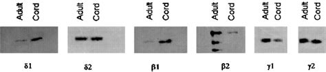 Immunoprecipitation Of PLC Isoforms From Adult And Cord T Cells PLC Download Scientific