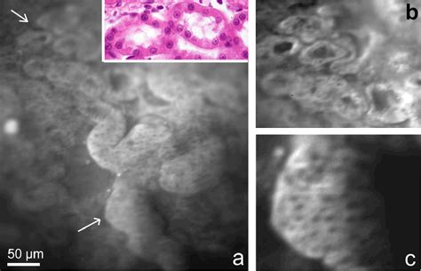 Figure 2 From Imaging Of Tissue Micro Structures Using A Multi Modal Microscope Design