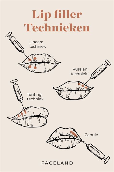 Ben Je Benieuwd Welke Lipfiller Techniek Het Beste Bij Jouw Lippen Past Lees Alles Over De
