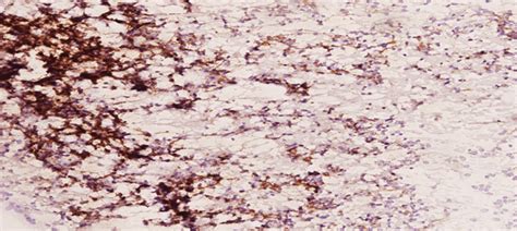 Showing Synaptophysin Positive Download Scientific Diagram