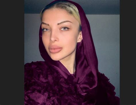 چهره همسر سپهر حیدری قبل از عمل های زیبایی فراوانش عکس روزنو