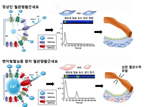 서울대학교병원