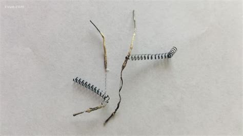 Essure Device