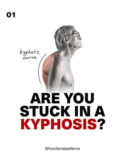 Functional Patterns On Linkedin Functionalpatterns Fpisthestandard