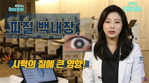 다양한 백내장 종류 발생 원인과 증상까지 다 알려드립니다 The 비앤빛 블로그