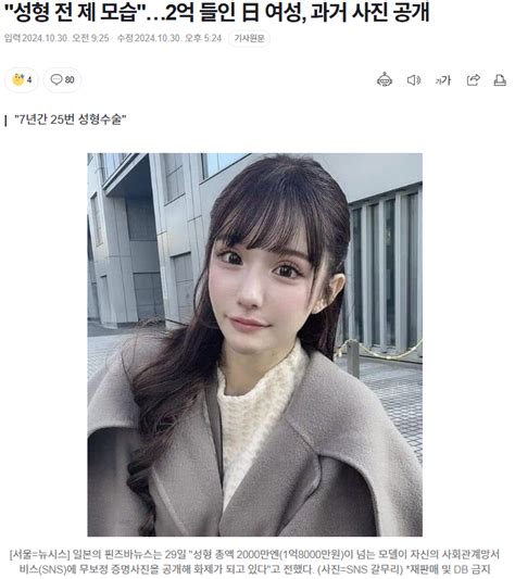 2억들여 성형한 日여성 과거 사진 공개 유머 움짤 이슈 에펨코리아