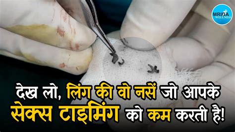 Boost Your Sex Life Dorsal Neurectomy P Shot And Botox I Advanced Male Sexual Health Treatments