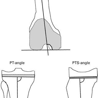 Internal External Rotation Of The Tibia With A Fixed Femur Download Scientific Diagram