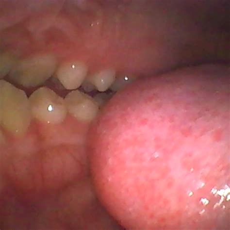 Bending Tongue Tip Object Detection Dataset By Test