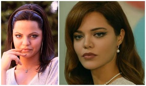 თურქი ვარსკვლავები პლასტიკურ ოპერაციებამდე ცვლილება გაგაოცებთ ნაწილი 1