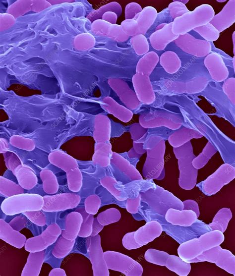 Acinetobacter Baumannii Sem Stock Image C032 2345 Science Photo Library